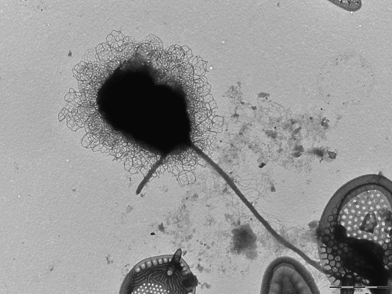 Paraphysomonas butcheri | Silica-scaled chrysophytes of Europe
